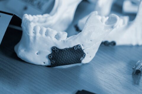 The Rise of Functional Prototypes Developed with 3D Printing